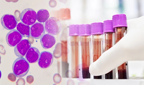 Endocrinology and Metabolism - Medicine | Trinity College Dublin