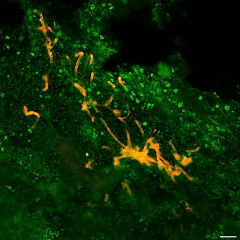 Microbial Ecology of Soil Treatment System - Civil Structural ...