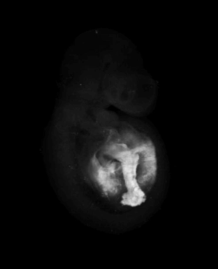 Wnt 2 - Zoology | Trinity College Dublin