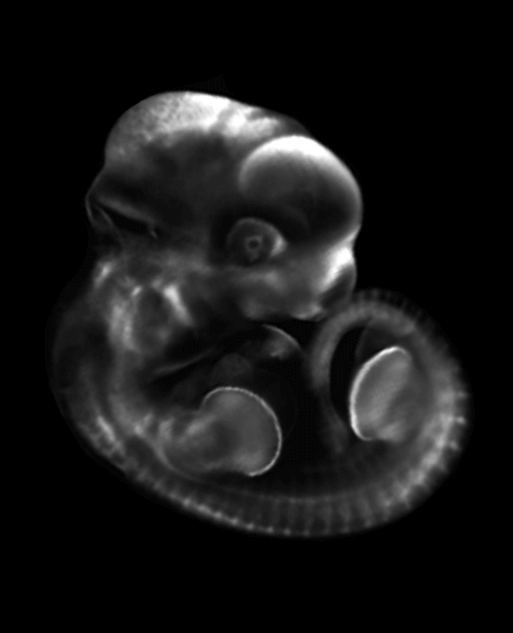 Frizzled Expression - Zoology | Trinity College Dublin