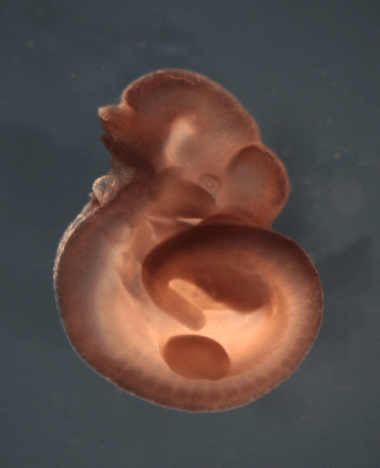 Fzd3 - Zoology | Trinity College Dublin