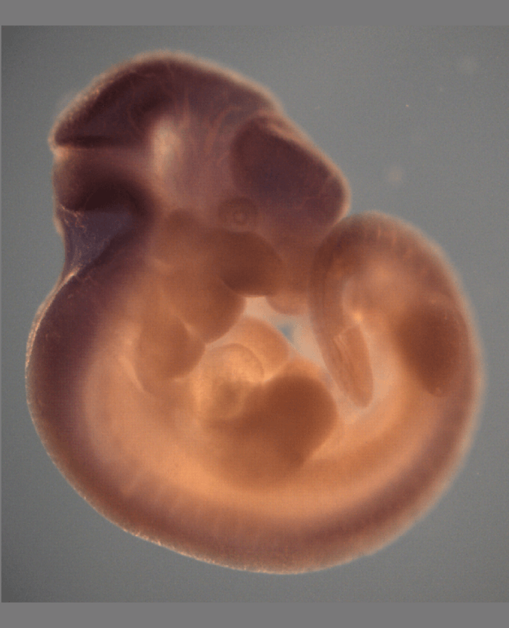 Fzd3 - Zoology | Trinity College Dublin