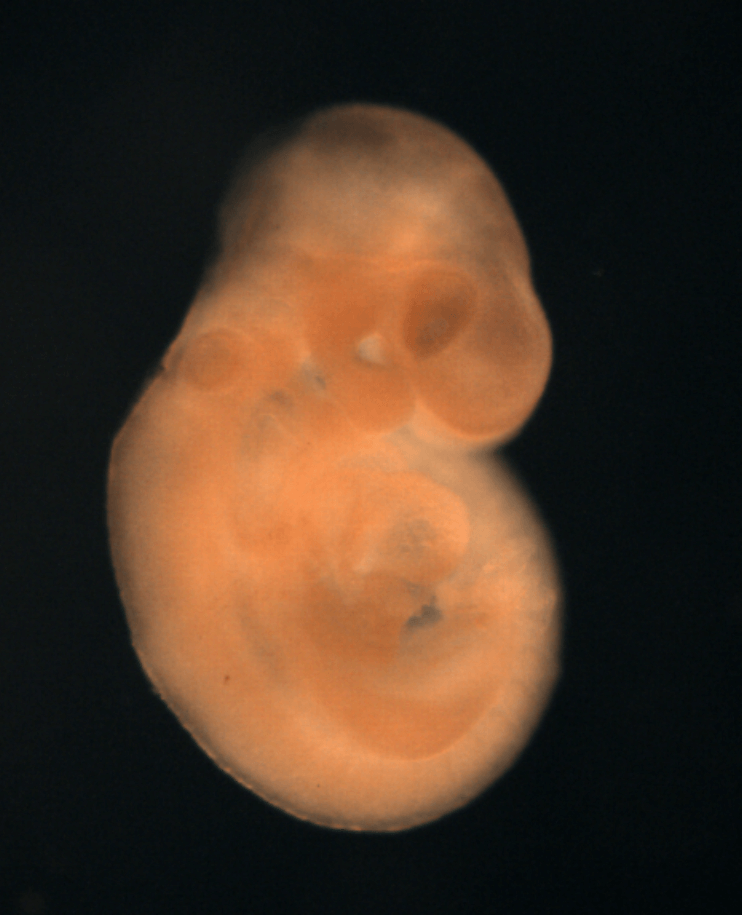 Fzd5 - Zoology | Trinity College Dublin