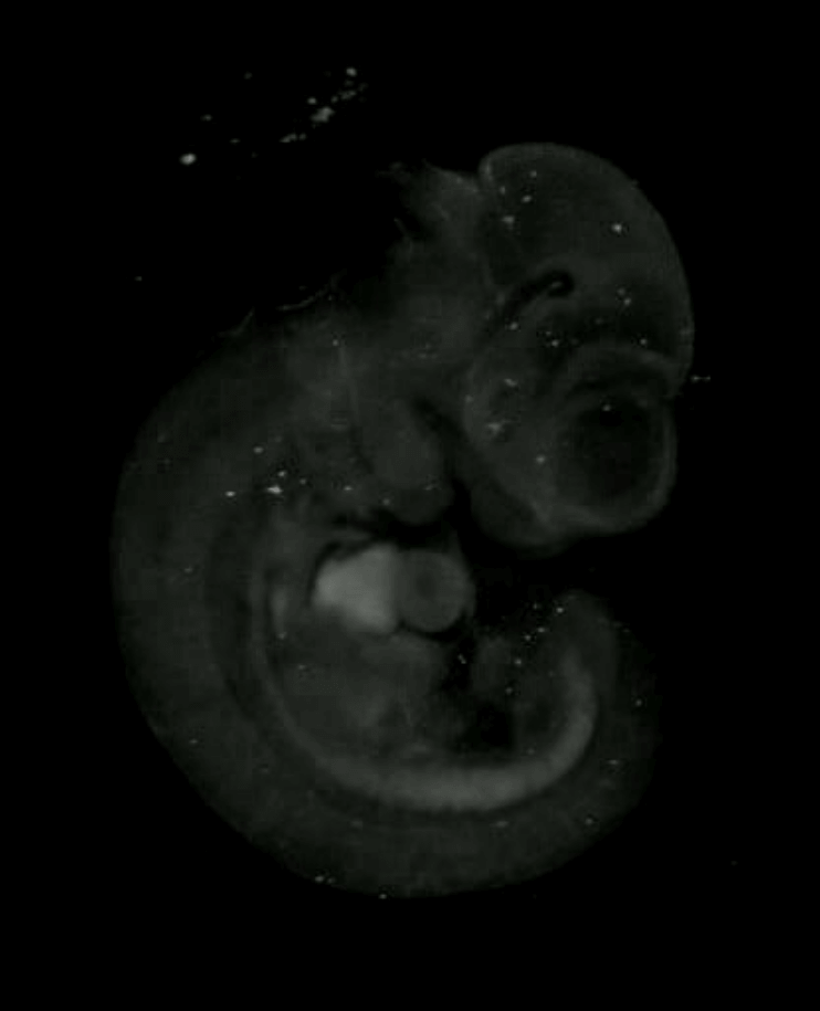 Fzd5 - Zoology | Trinity College Dublin