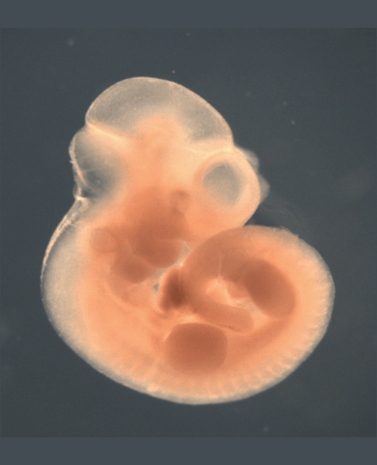 Fzd5 - Zoology | Trinity College Dublin