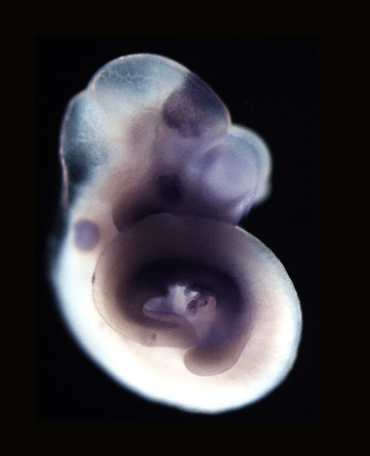 Tcf 4 - Zoology | Trinity College Dublin