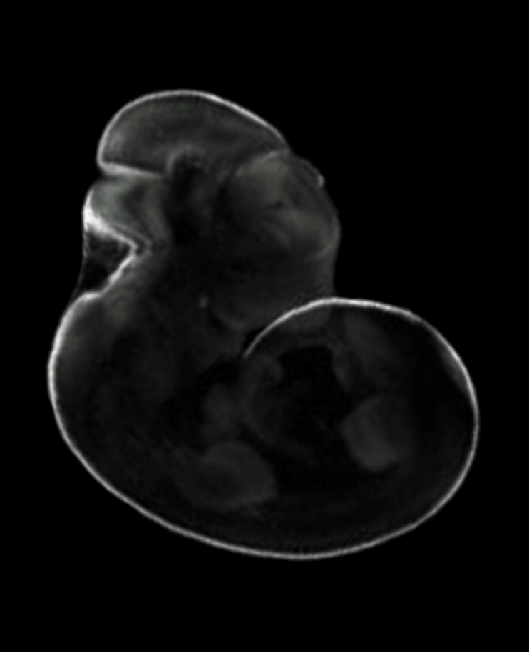 Wnt Expression - Zoology | Trinity College Dublin