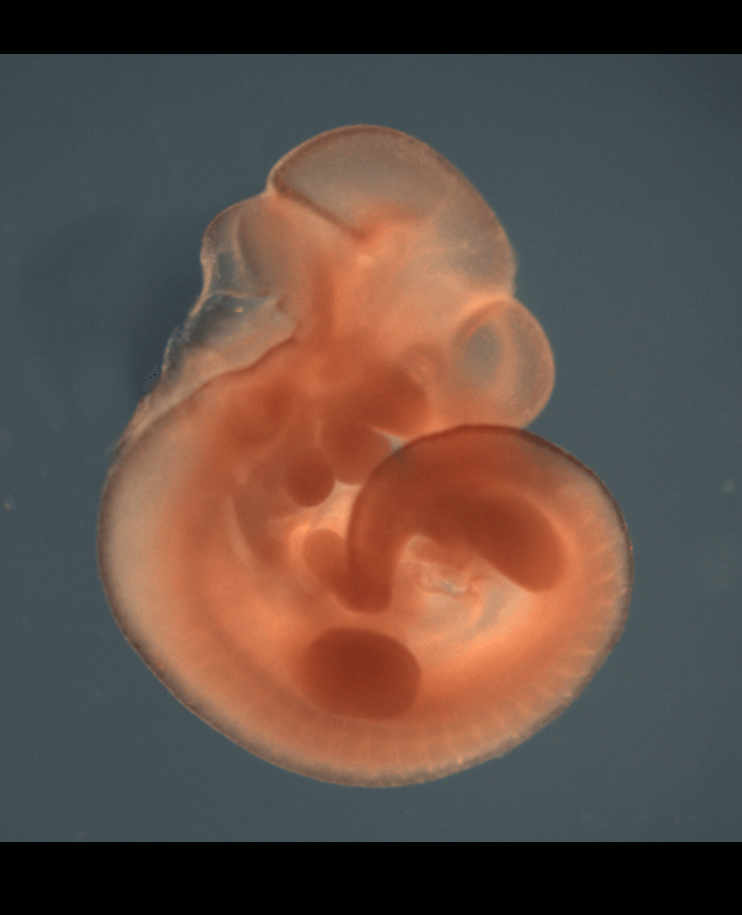 Wnt1 - Zoology | Trinity College Dublin