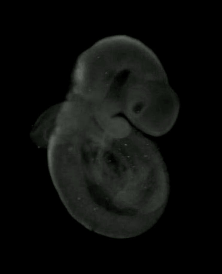 Wnt 3 - Zoology | Trinity College Dublin