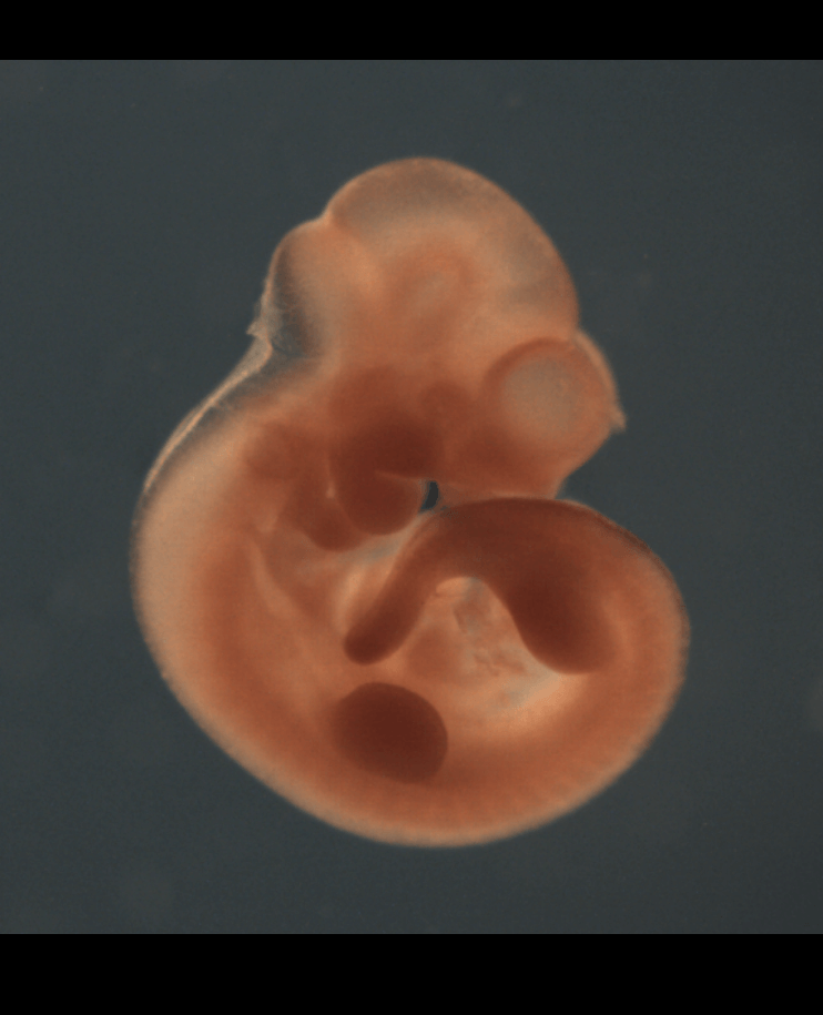 Wnt 3a - Zoology | Trinity College Dublin