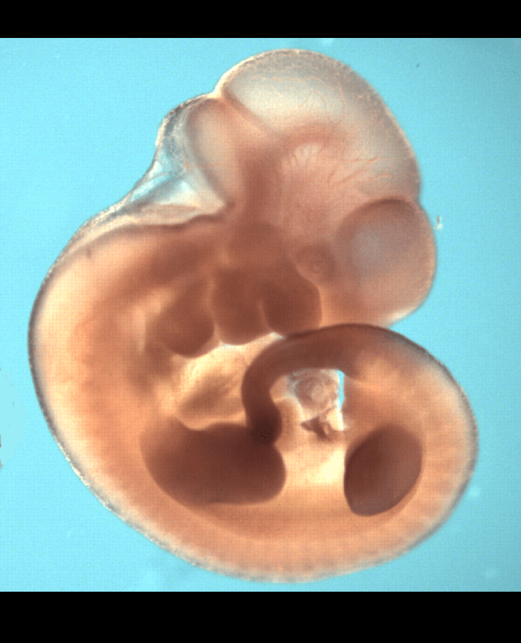 Wnt 3a - Zoology | Trinity College Dublin