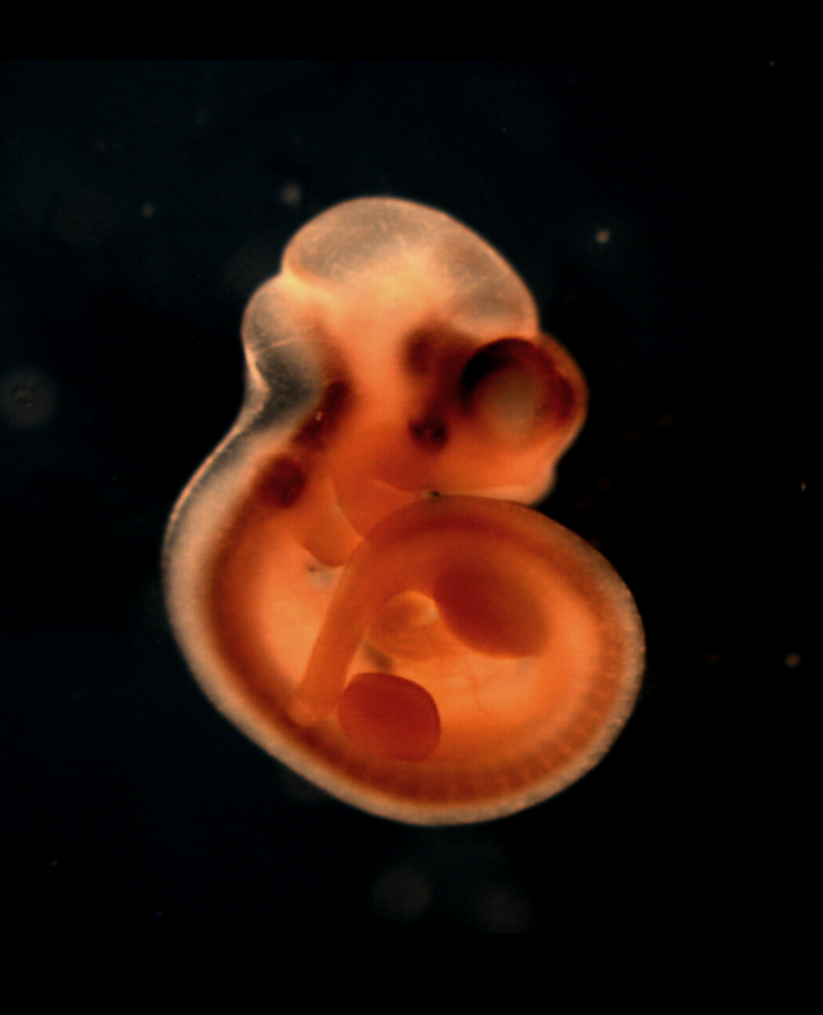 Wnt 7b - Zoology | Trinity College Dublin