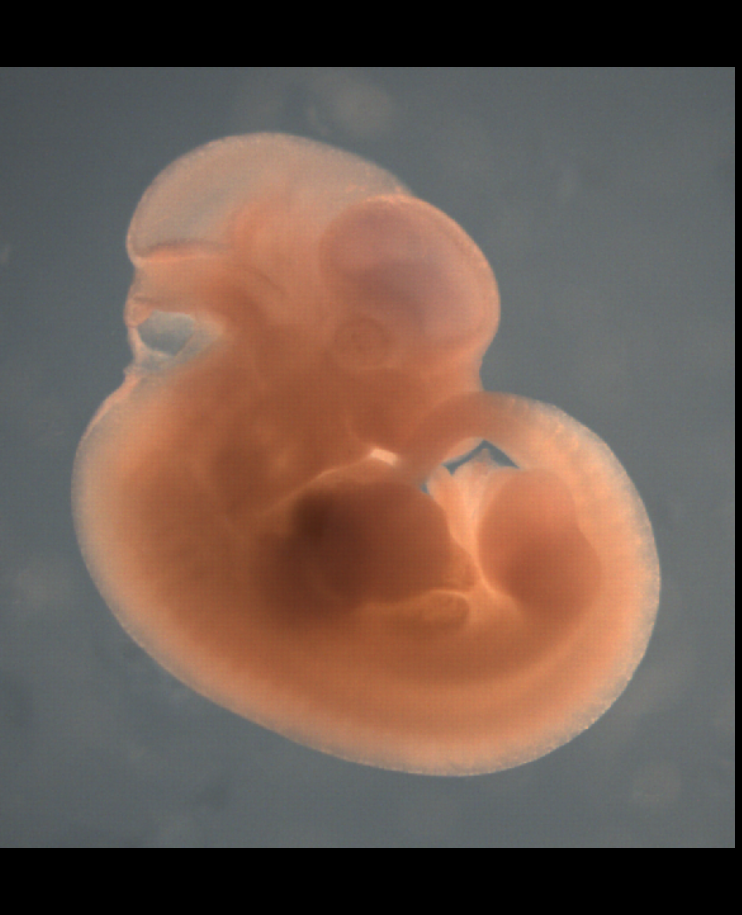 Wnt 9a - Zoology | Trinity College Dublin